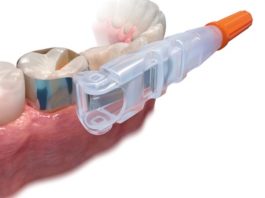 Omni-Matrix porta matriz descartable y matriz - dentaltvweb