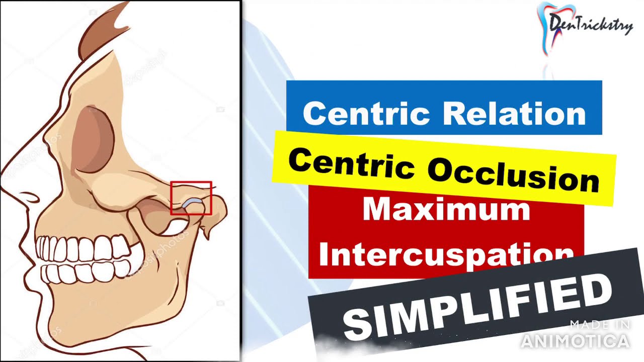 Centric Relation, Centric Occlusion & Maximum Intercuspal Position (CR ...